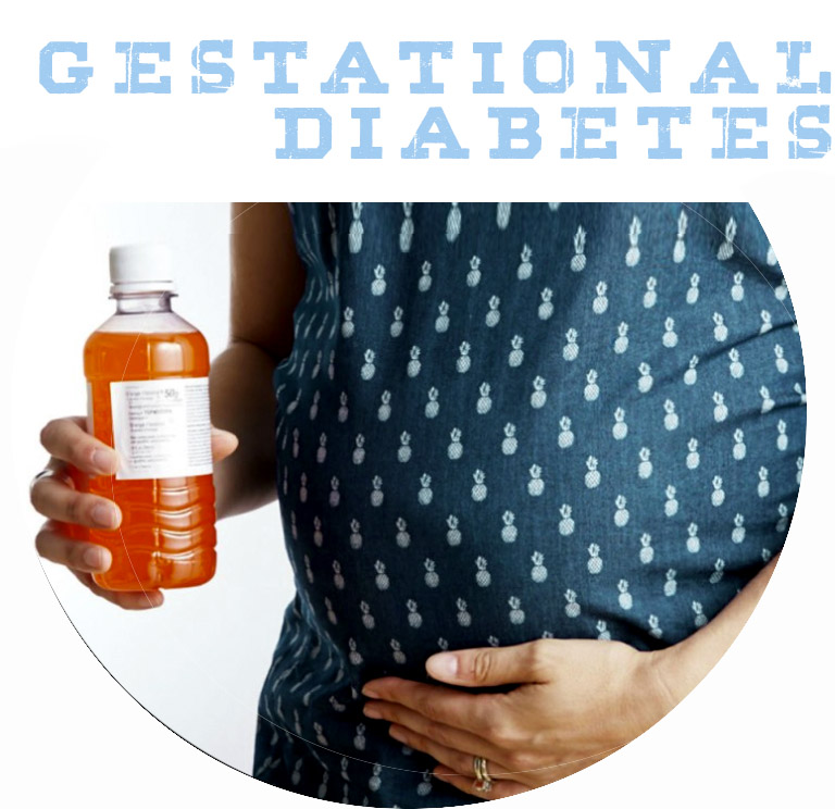Diet and physical activity and Gestational Diabetes - PATIA Diabetes